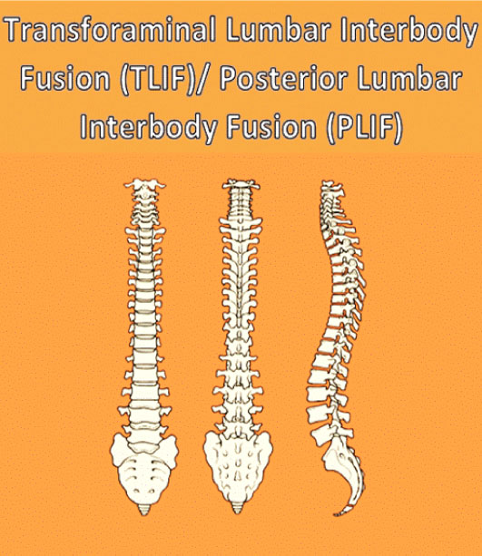 Patient Information Leaflets - Spine and Brain