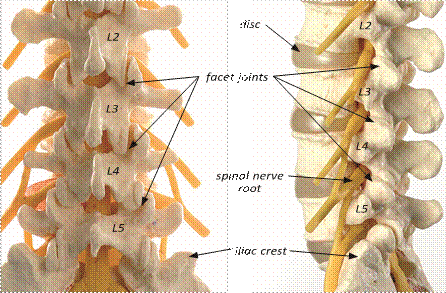 Lumbar Facet Joint Syndrome - Injection Treatment - Spine and Brain