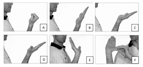 Carpal Tunnel Syndrome - Spine and Brain